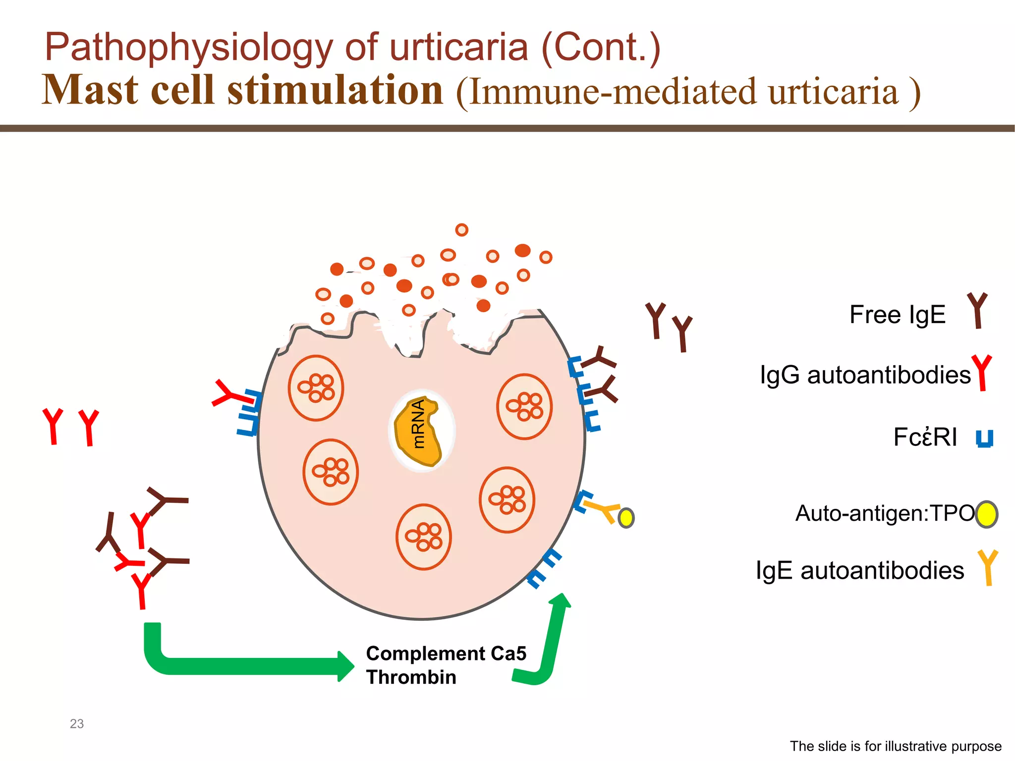 chronic urticaria | PPTX
