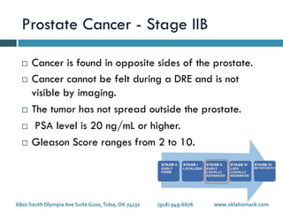 Stages of Prostate Cancer | PPT