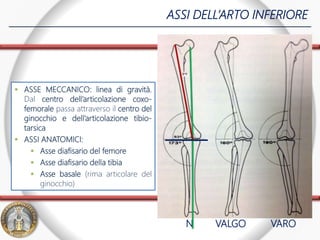 Osteotomia di ginocchio | PPTX