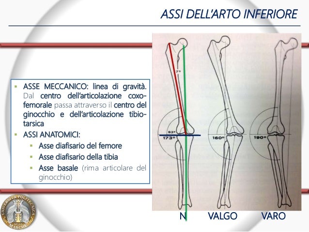 Osteotomia di ginocchio