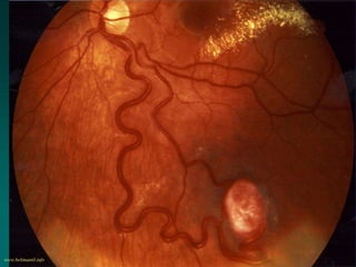 Oko anatomija i fiziologija | PDF