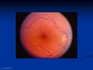 Oko anatomija i fiziologija | PDF