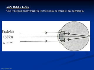 Oko anatomija i fiziologija | PDF