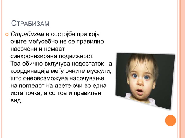 Okoto kako opticki sistem | PPTX