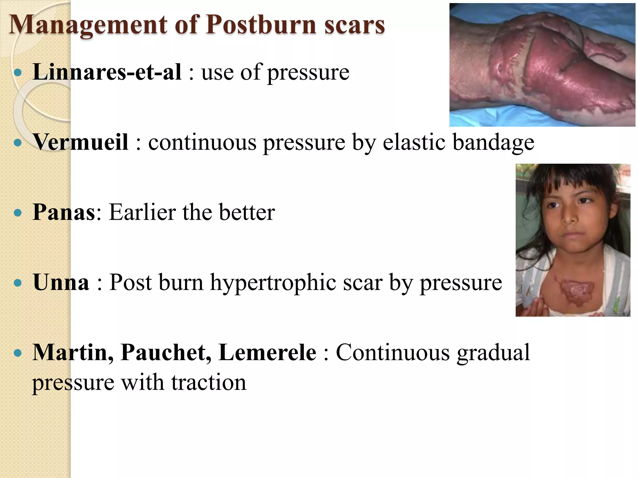 Ok's operative techniques inn burn management | PPT