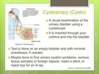 Urinary System | PPTX | Infectious Diseases | Diseases and Conditions