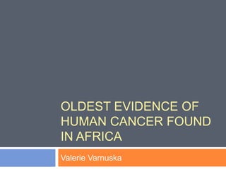 Oldest Evidence of Human Cancer Found in Africa | PPTX