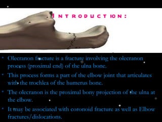 Olecranon fracture | PPT