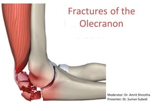 Olecranon# | PPTX