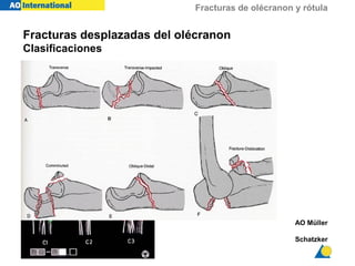 Olecranon rotula | PPT