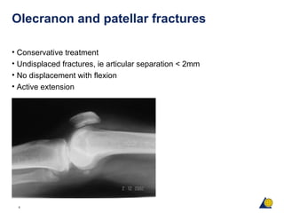 Olecranon fractures and patellar fractures.ppt