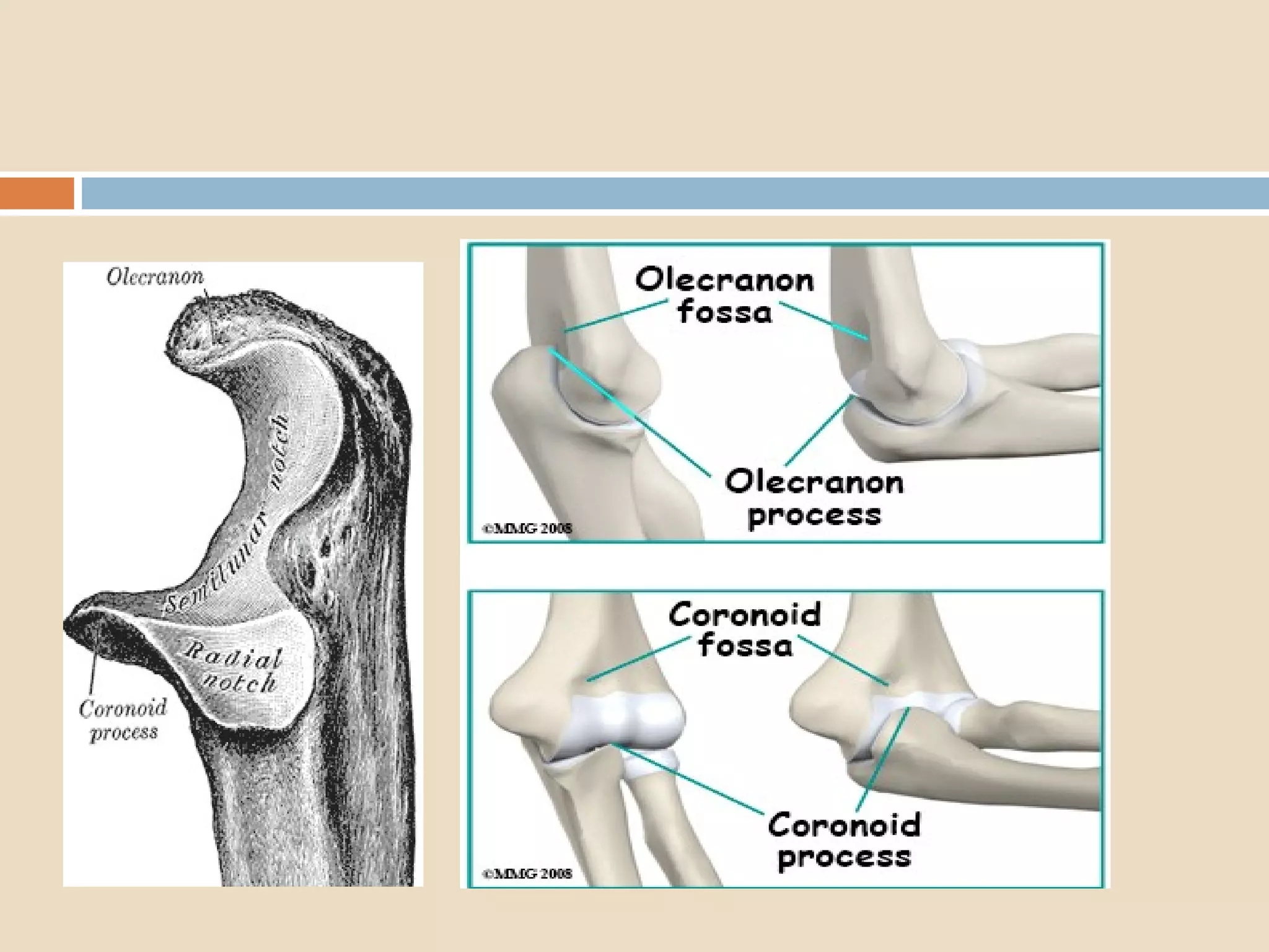 Olecranon fracture | PPT