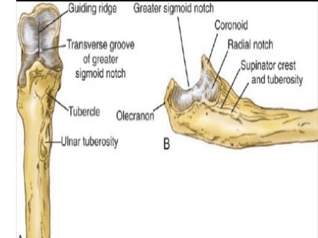 olecranon fracture, anatomy clinical picture.pptx