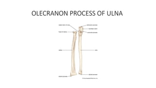 Topic on OLECRANON FRACTURE slides.pptx