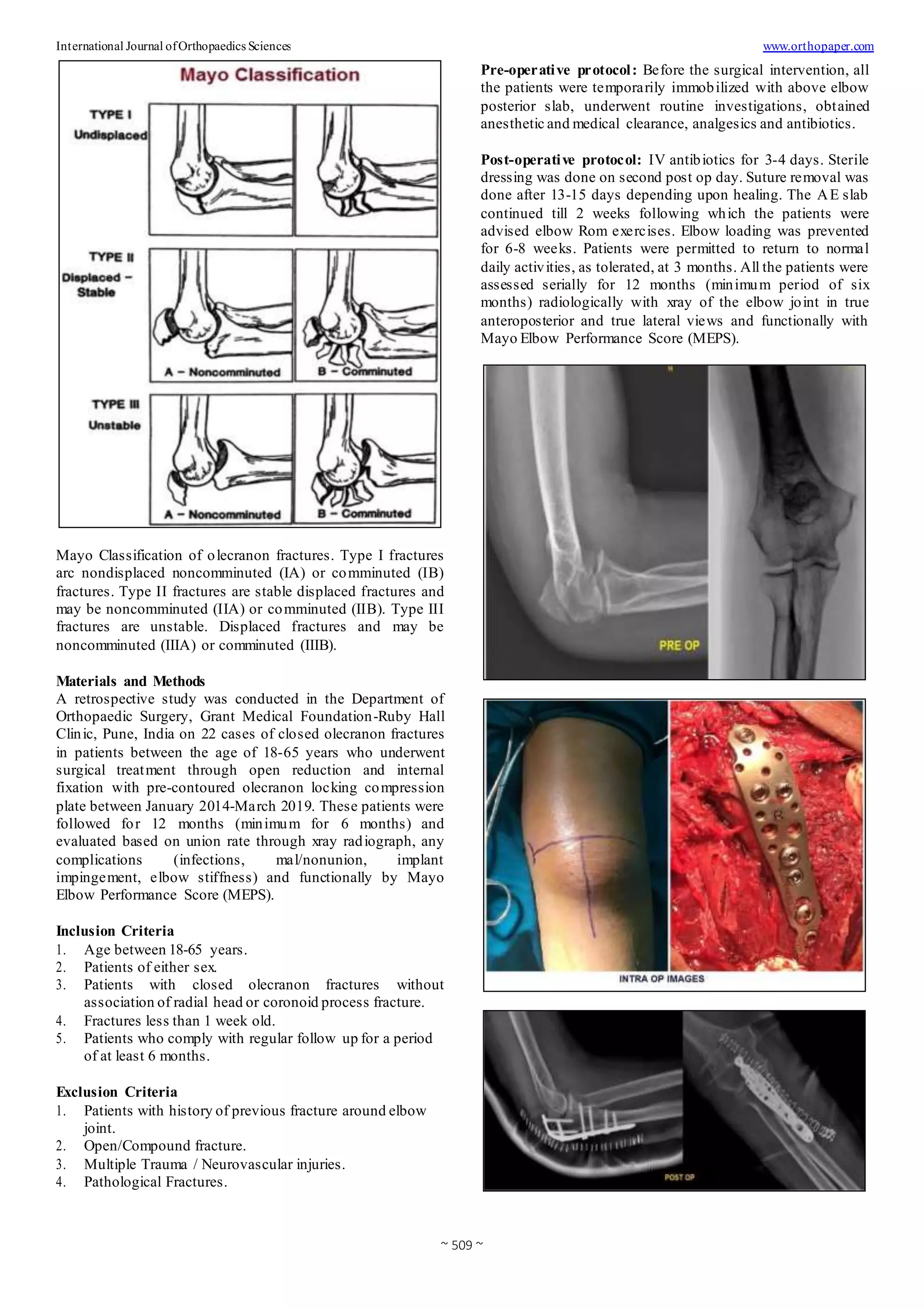Elbow Joint - Olecranon fracture | DOCX
