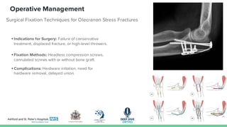 Olecranon Stress Fractures presentations and treatment options | PDF