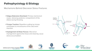 Olecranon Stress Fractures incidence and treatments | PDF