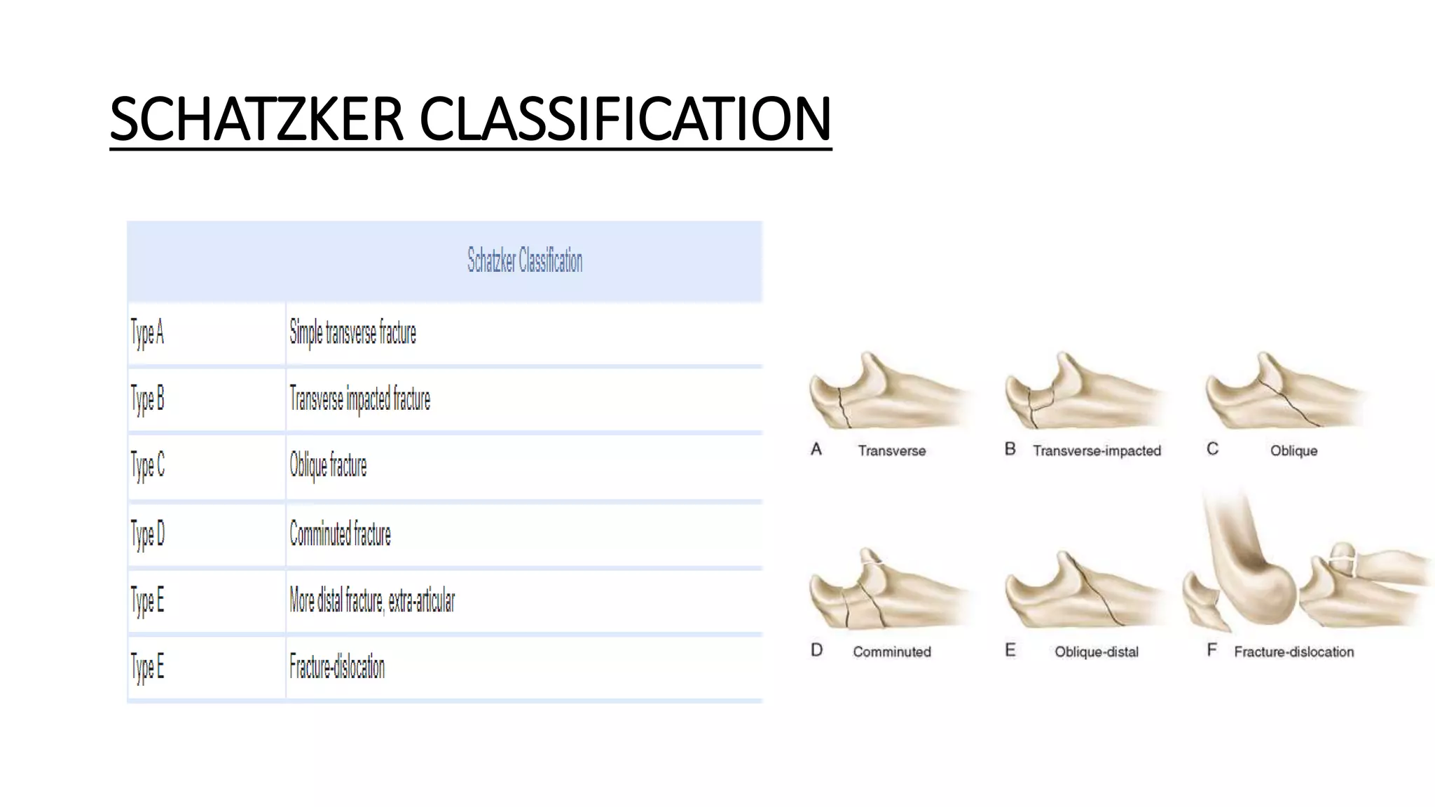 Olecronon and radial head fractures (1).pptx