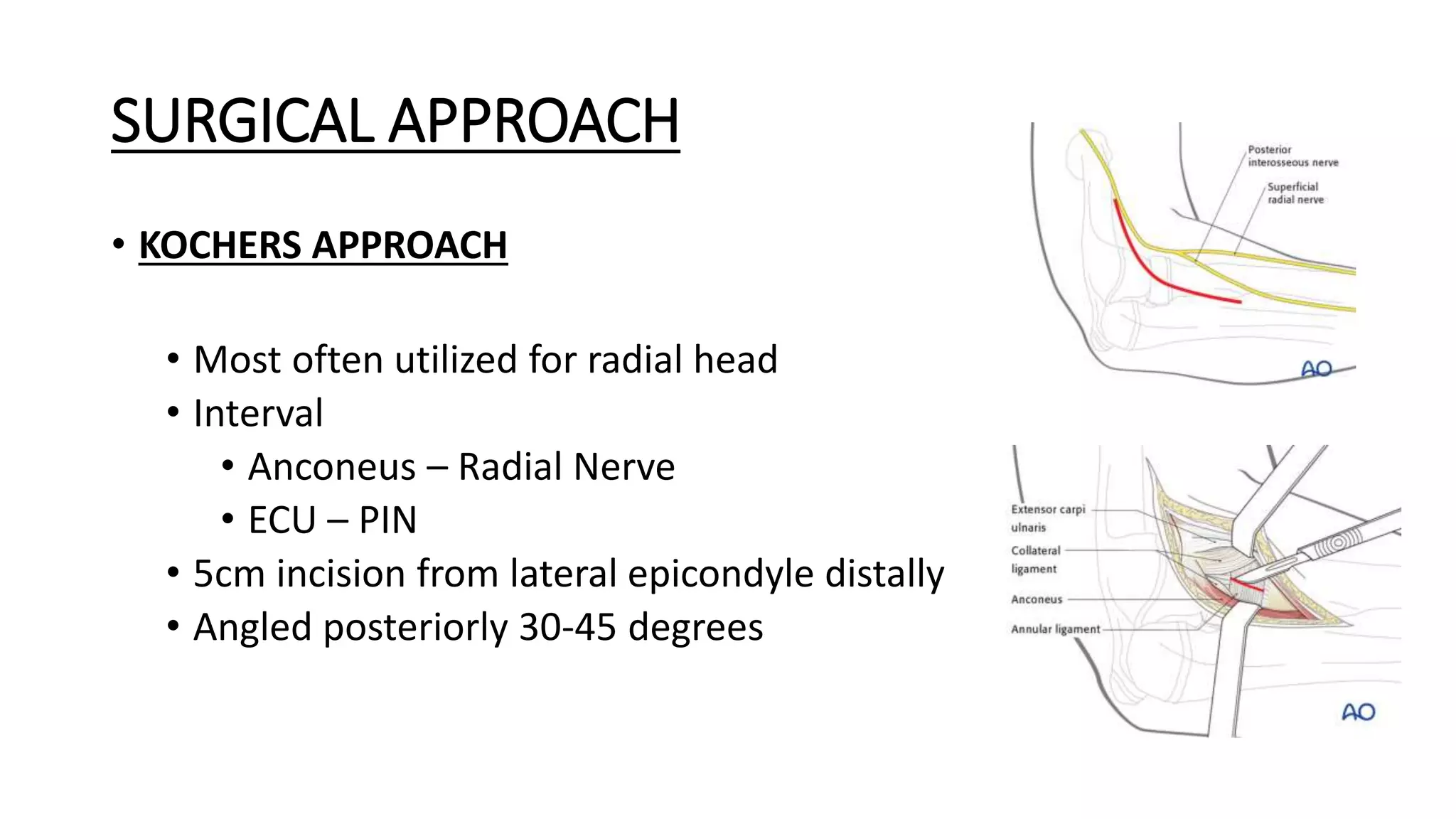 Olecronon and radial head fractures (1).pptx