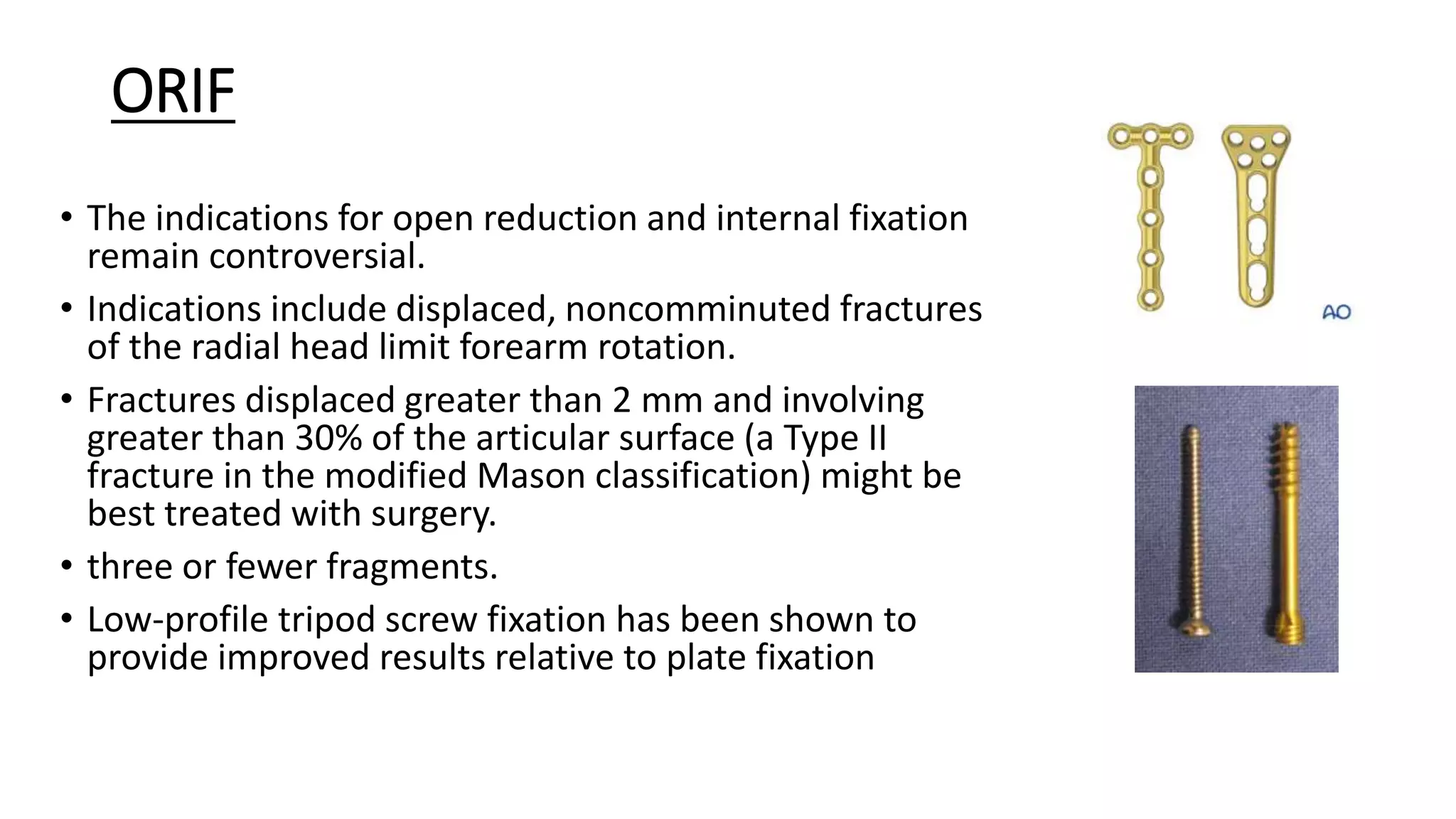 Olecronon and radial head fractures (1).pptx