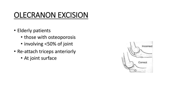 Olecronon and radial head fractures (1).pptx