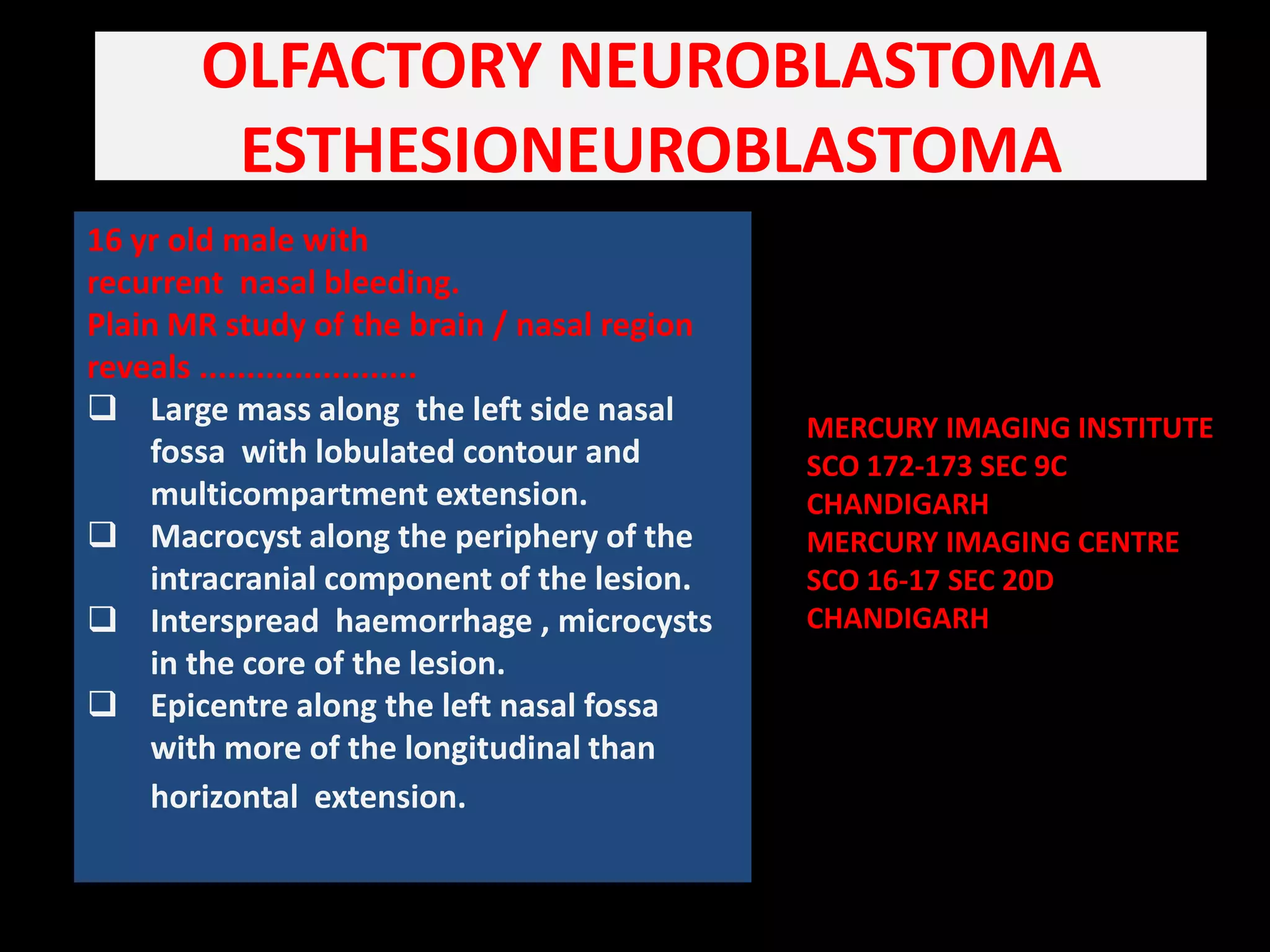 Olfactory neuroblastoma | PPTX