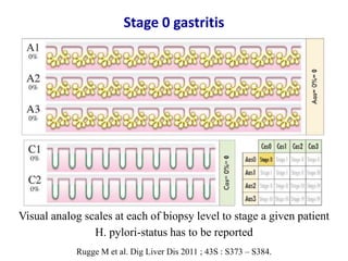 Olga staging system for diagnosis of gastritis | PPTX