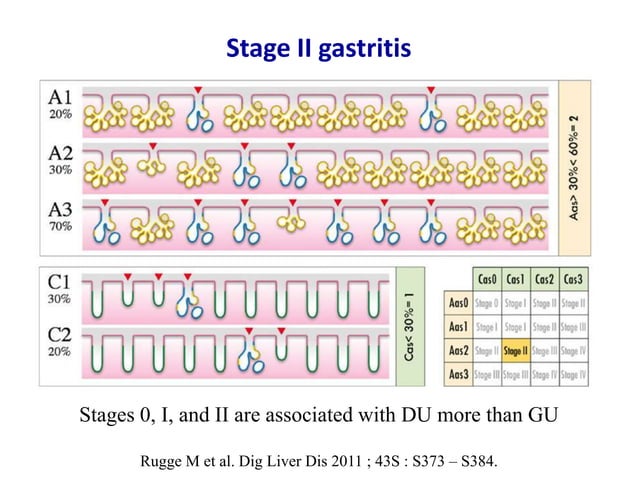 Olga staging system for diagnosis of gastritis | PPTX