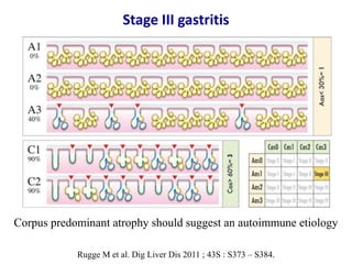 Olga staging system for diagnosis of gastritis | PPTX