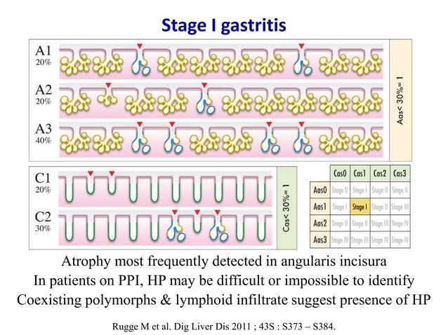 Olga staging system for diagnosis of gastritis | PPT