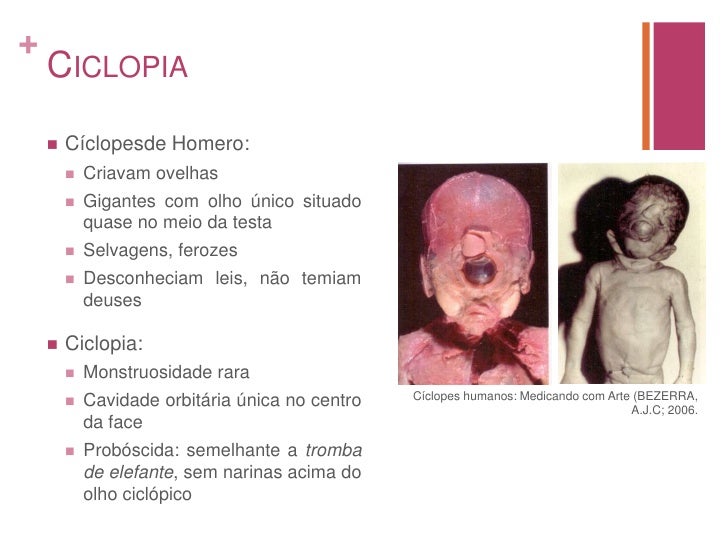 Olhos, medicina e arte