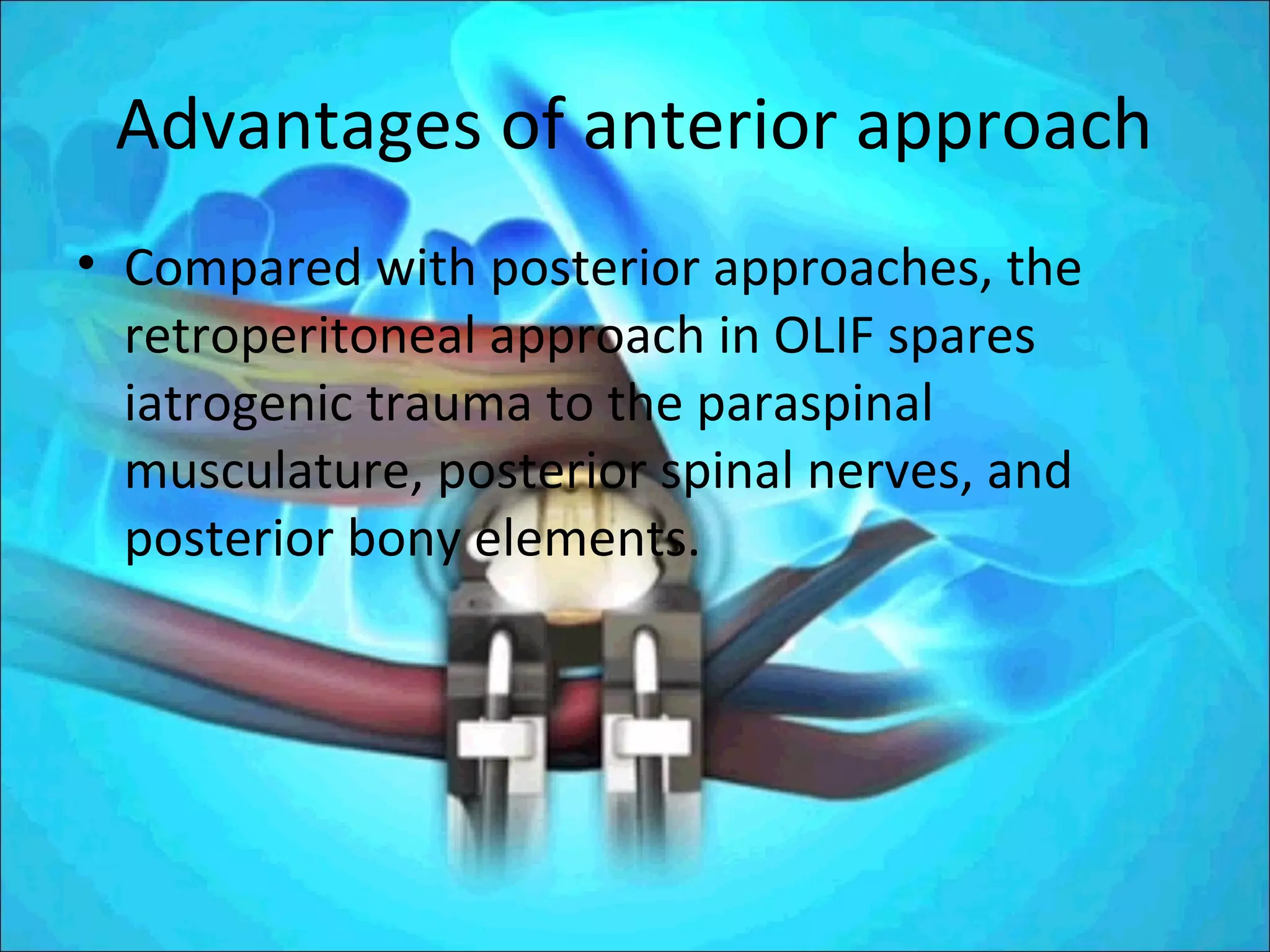 OLIF-oblique lumbar interbody fusion | PPT