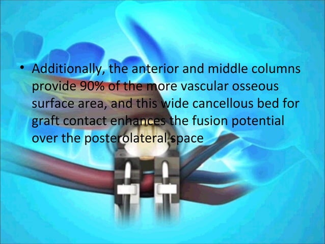 OLIF-oblique lumbar interbody fusion | PPT