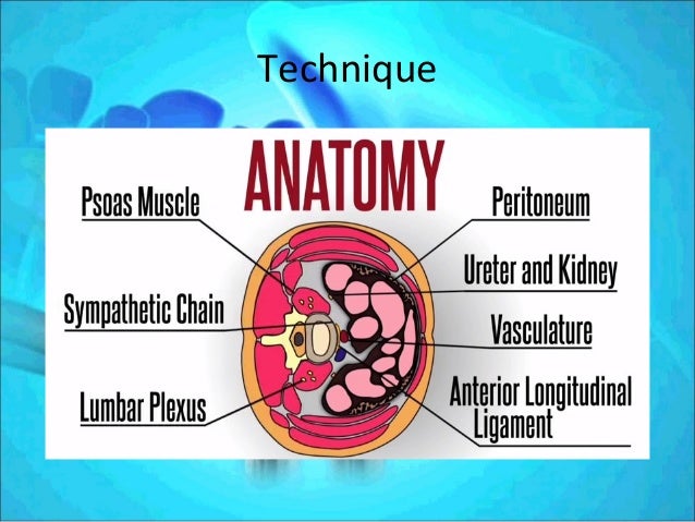 OLIF-oblique lumbar interbody fusion
