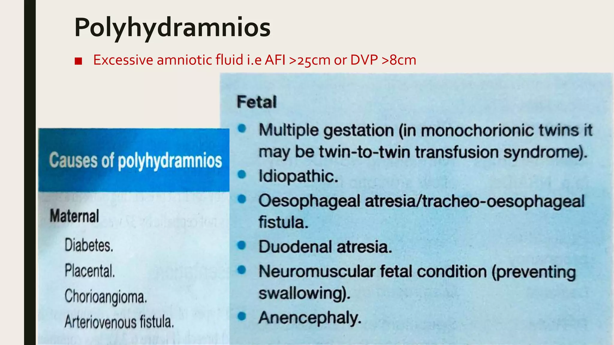 oligo and polyhydramnios.pptx