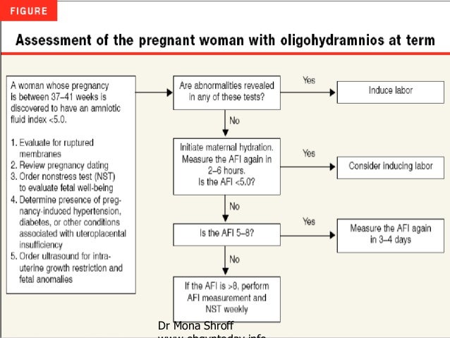 Oligohydramnios Acog Guidelines