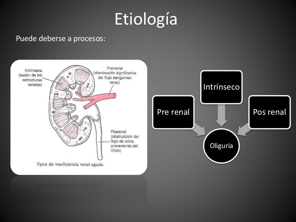 O Que Significa Oliguria - LIBRAIN