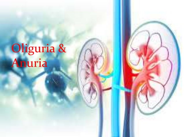 Oliguria and anuria | PPT