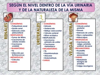 Oliguria y anuria | PPTX