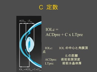 IOL度数計算式 Olsen式の C定数 | PPTX | Physics | Science