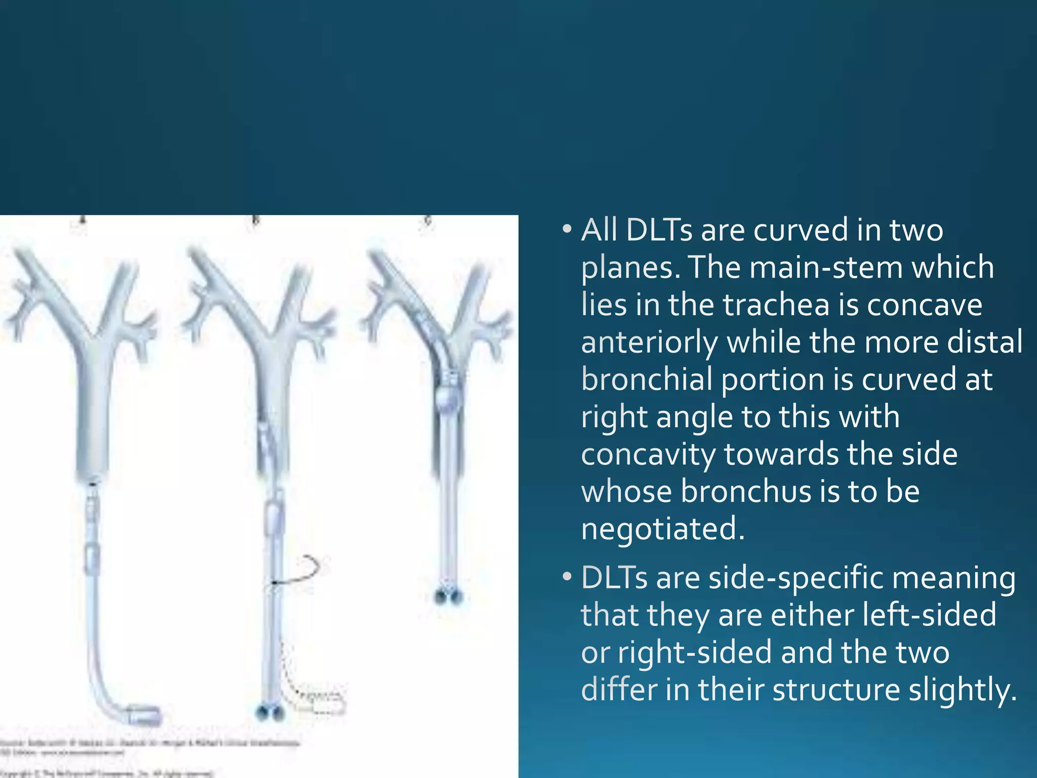 One Lung Ventilation | PPTX
