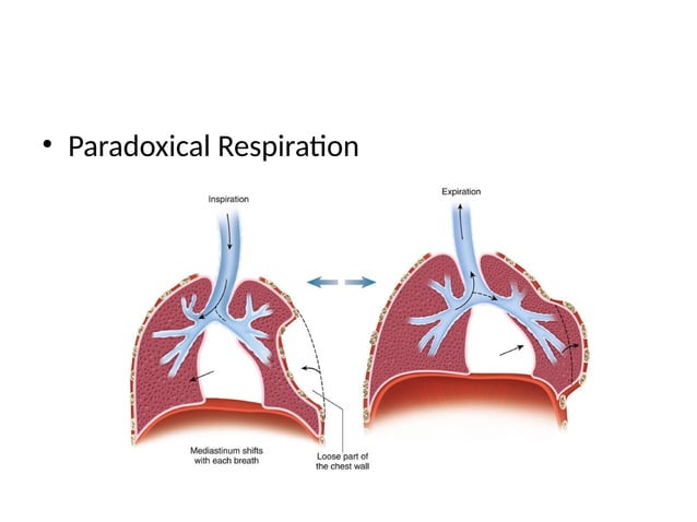 OLV - Physiology and pathology one lungs | PPT