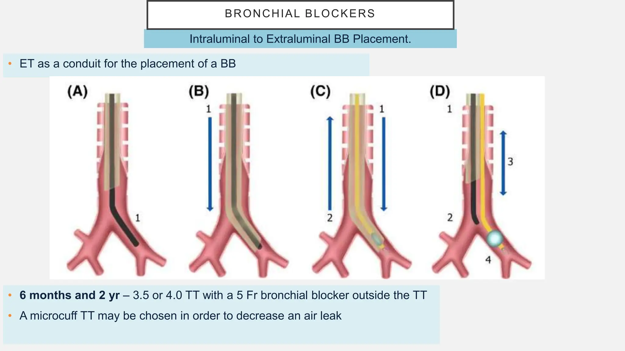 One lung ventilation in pediatric and adult patients | PPTX