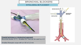 One lung ventilation in pediatric and adult patients | PPTX