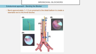 One lung ventilation in pediatric and adult patients | PPTX