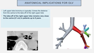 One lung ventilation in pediatric and adult patients | PPTX