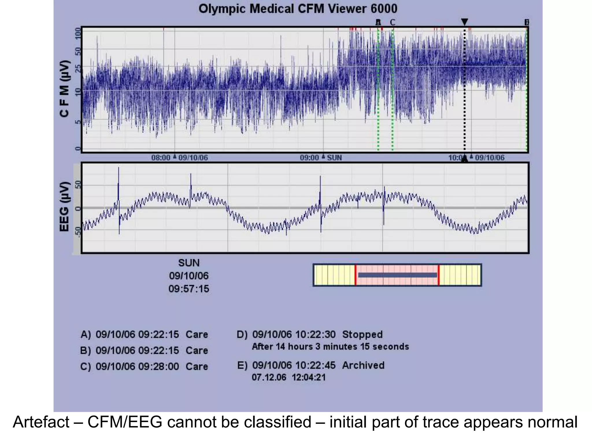 Olympic CFM cases.ppt