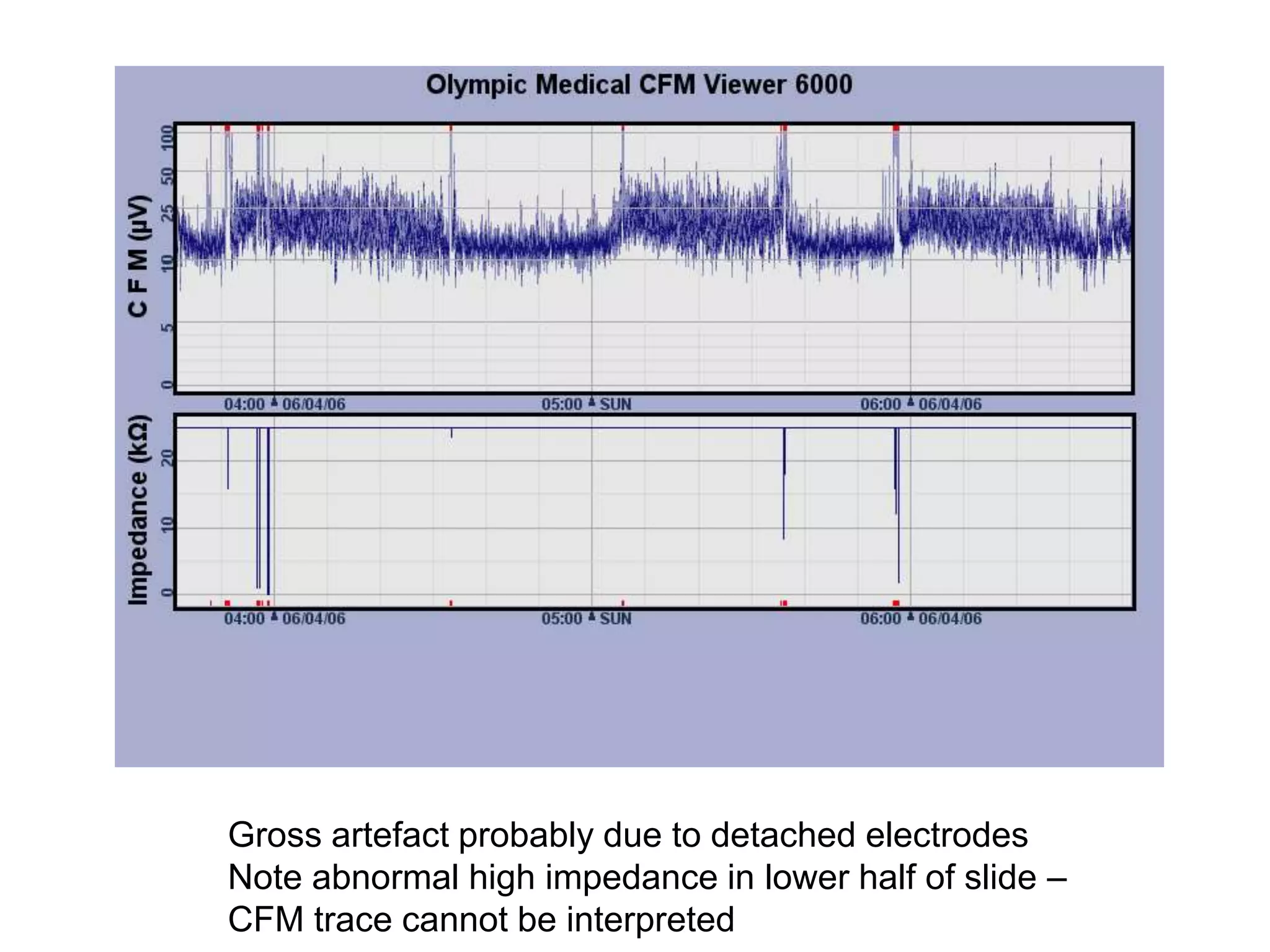 Olympic CFM cases.ppt