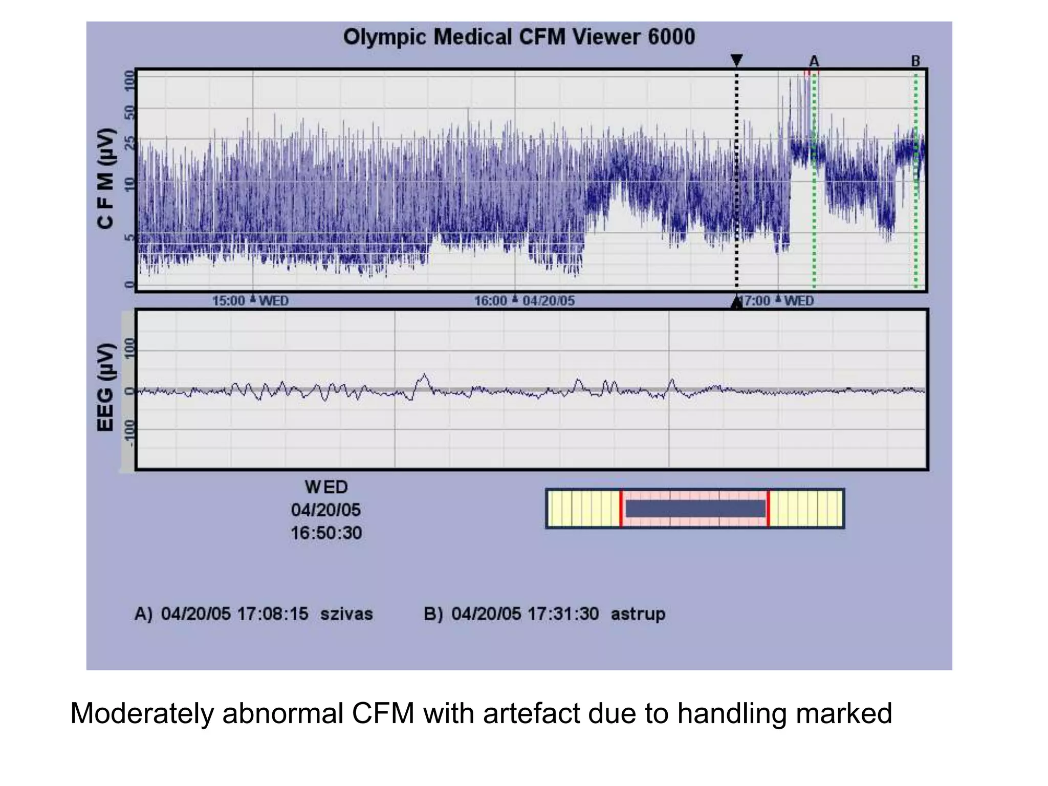 Olympic CFM cases.ppt