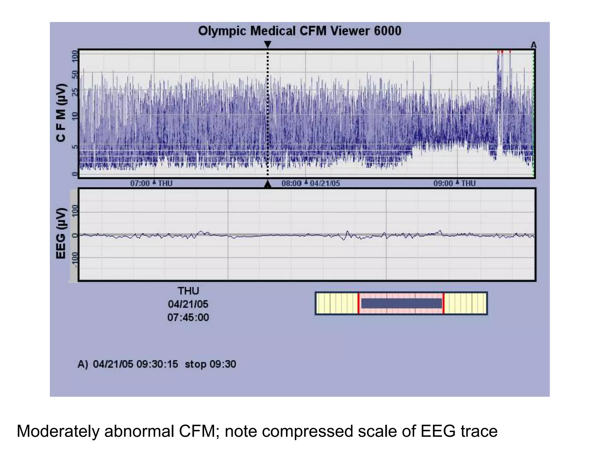 Olympic CFM cases.ppt
